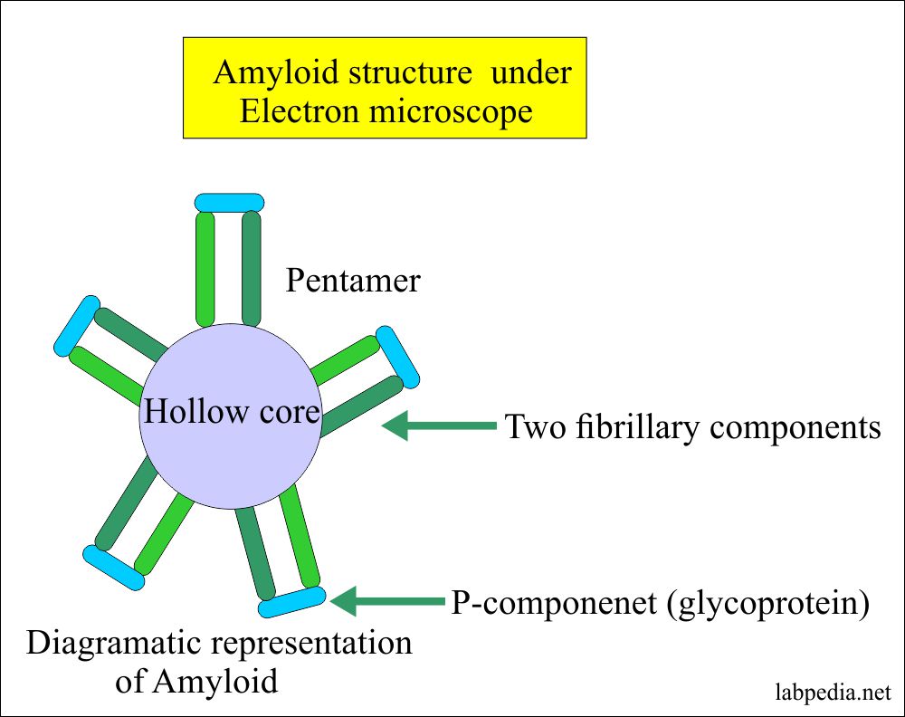 Amyloidosis – Labpedia.net