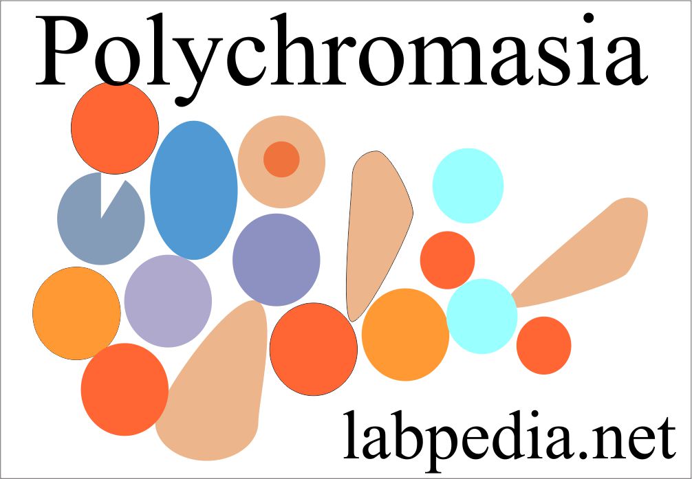 Anemia classification, diagnosis, and routine workup