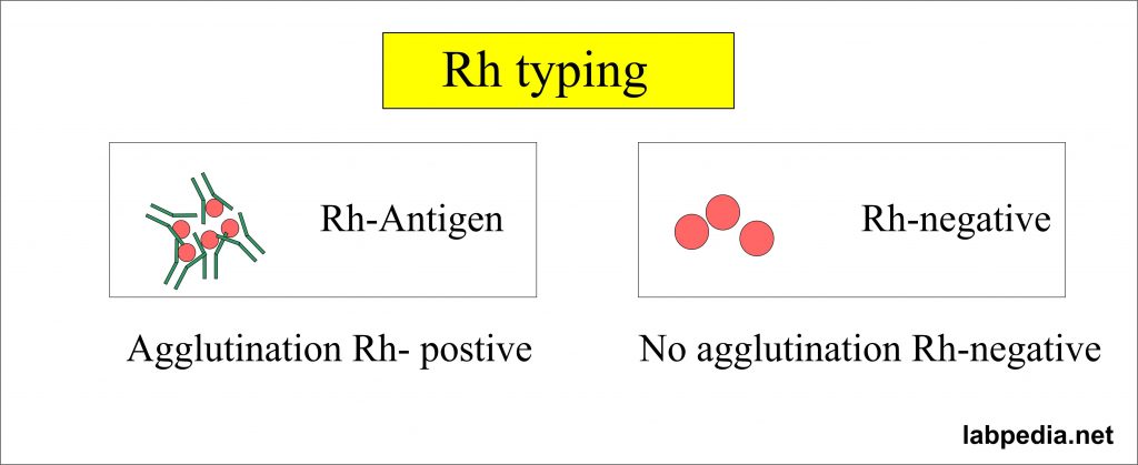 Blood banking – part 1- Blood Grouping (Blood ABO and Rh Typing ...
