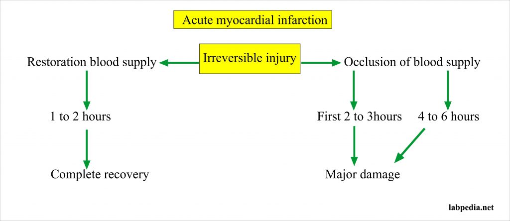 Cardiac marker – Part 1 – Diagnosis of Acute Myocardial Infarction, AMI ...