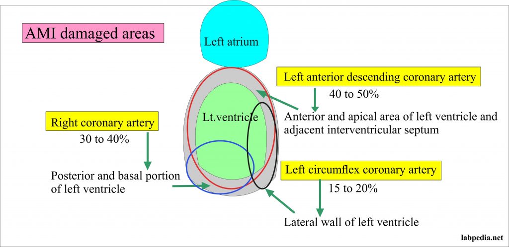 Cardiac marker – Part 1 – Diagnosis of Acute Myocardial Infarction, AMI ...