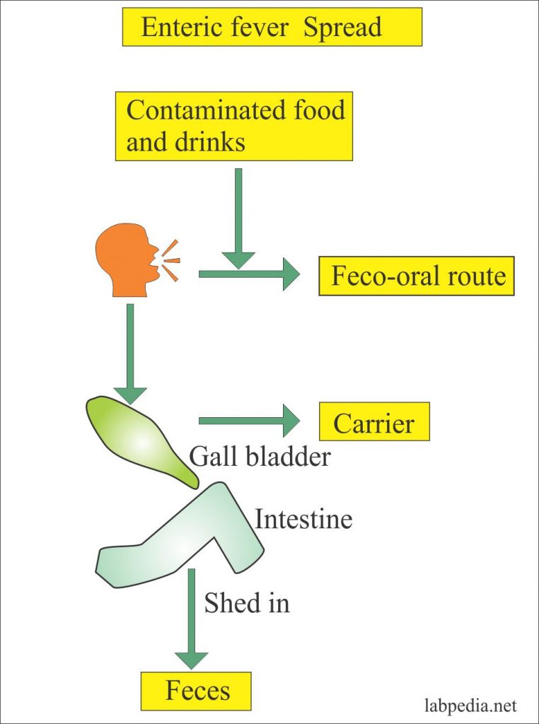 Enteric Fever – Part 1 – Typhoid Fever, Enteric Fever (Salmonella typhi ...