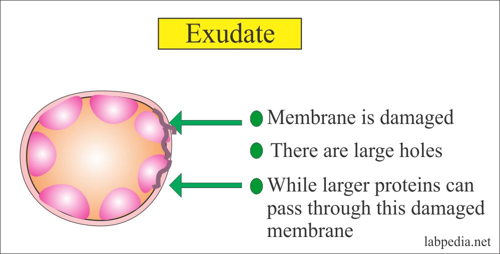 Fluid Analysis Part 1 Normal Findings Pleural Pericardial And Fluid Analysis Part 1 Normal Findings Pleural Pericardial And