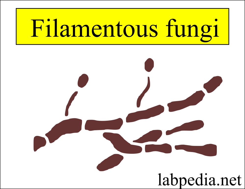 Fungus, Fungal infections, Diagnosis of Fungal infection – Labpedia.net