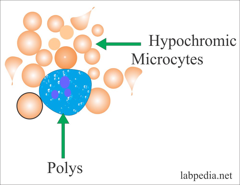 Mean Corpuscular Volume (MCV), Mean Cell Volume - Labpedia.net
