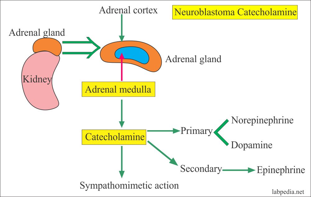 Neuroblastoma and Its Diagnosis - Labpedia.net