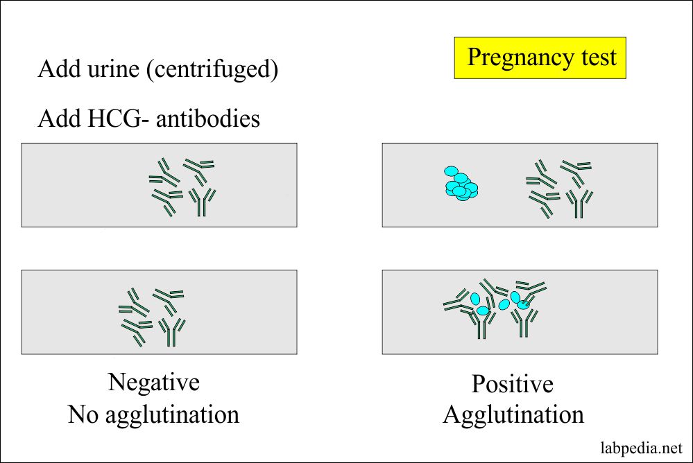 Pregnancy Blood Test Antibodies at Emily Jenkins blog