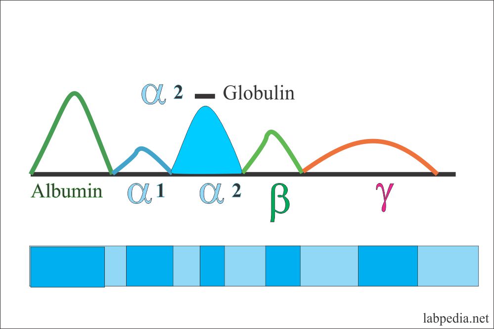 Protein Serum Electrophoresis Total Protein Albumin And Globulin