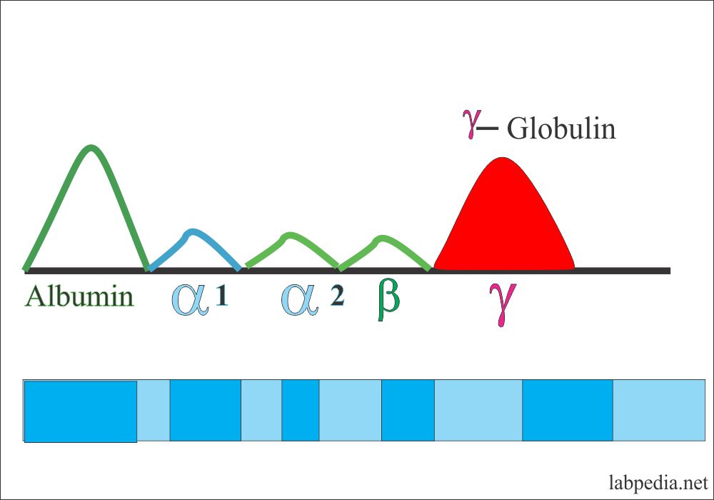 Protein Serum Electrophoresis Total Protein Albumin And Globulin
