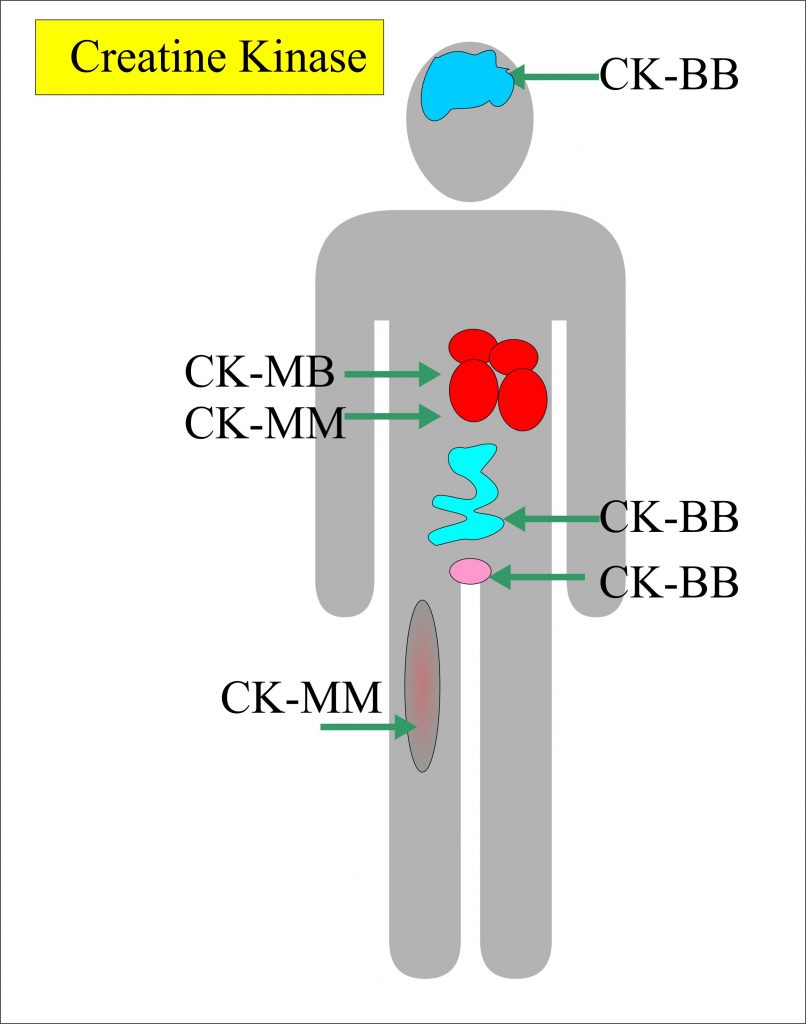 Tumor Marker:- Part 3 - Alk.phosphatase, CK, LDH, Acid phosphatase, and PSA - Labpedia.net