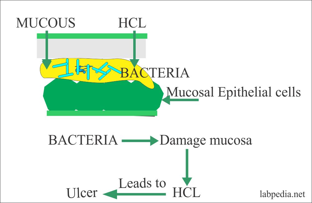 Urea Breath Test for H.Pylori (Helicobacter Pylori) - Labpedia.net