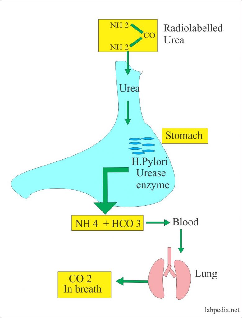 Urea Breath Test For H Pylori Helicobacter Pylori Labpedia