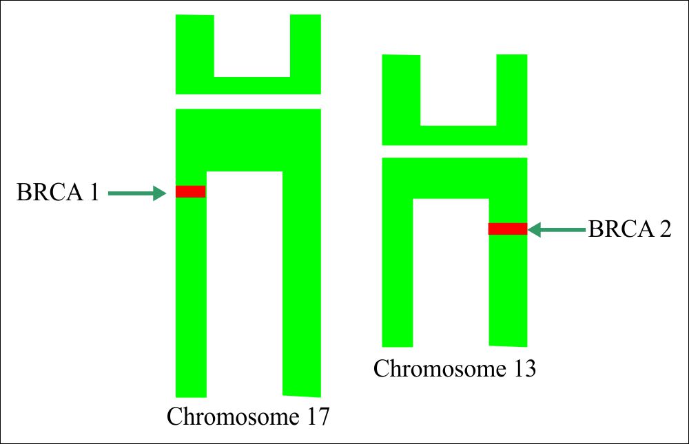 Tumor Marker – Part 6 – BRCA1, BRCA2, Significance in Breast Cancer – Labpedia.net