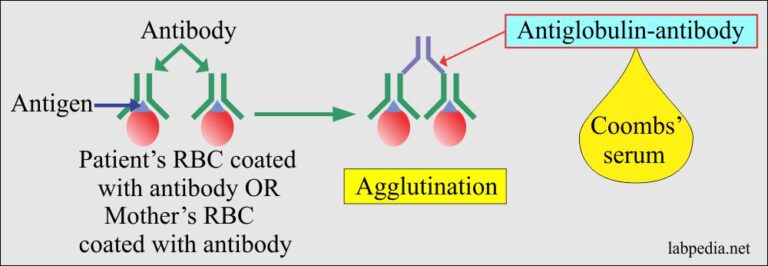 Coombs’ Test – Part 1- Coombs’ Direct, Direct-Anti-globulin test ...