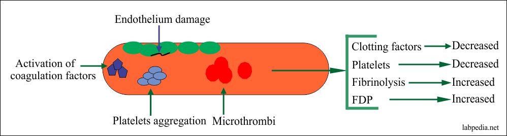D Dimer Test Fragment D Dimer Diagnosis Of Disseminated Intravascular