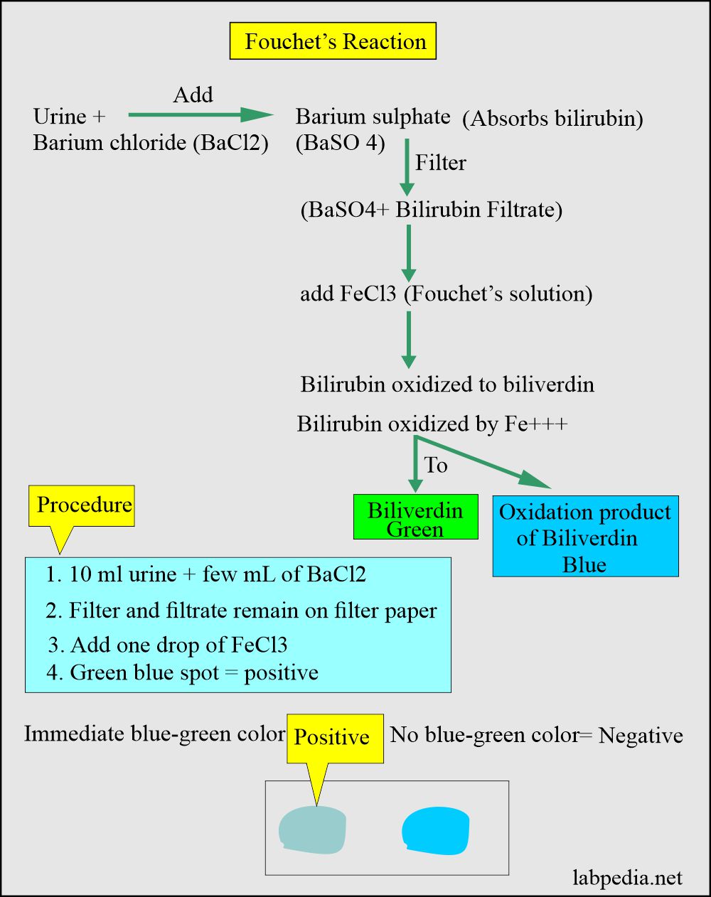 Urine For Bile pigments (Bilirubin, Urobilinogen, and Bile Salts ...