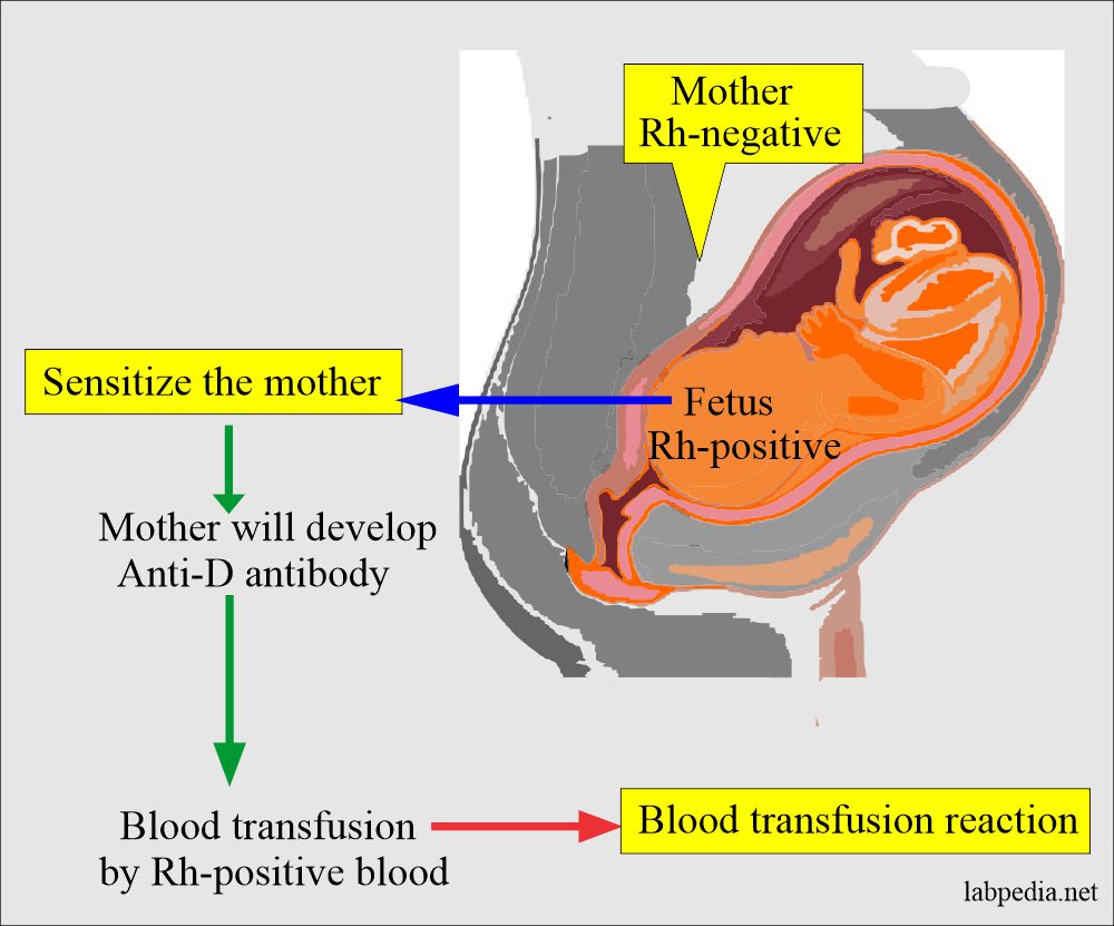 Blood banking:- part 1- Blood Groups ABO and Rh System, Blood Grouping ...