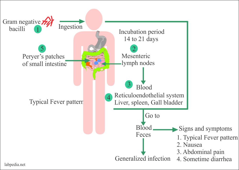Enteric fever – part 2 – Paratyphoid fever, Salmonella paratyphi ...