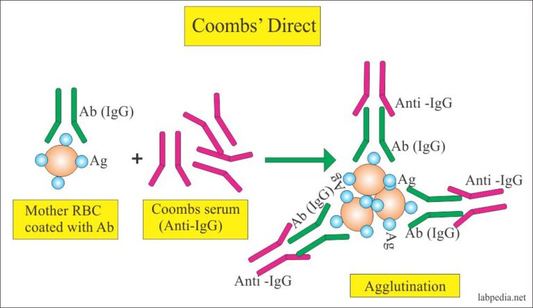Coombs’ Test – Part 3 – Hemolytic Anemia of Newborn, Rh-antibody, Anti ...