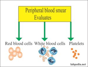 Complete blood count (CBC) – Part 1 – Differential count (CBC With ...