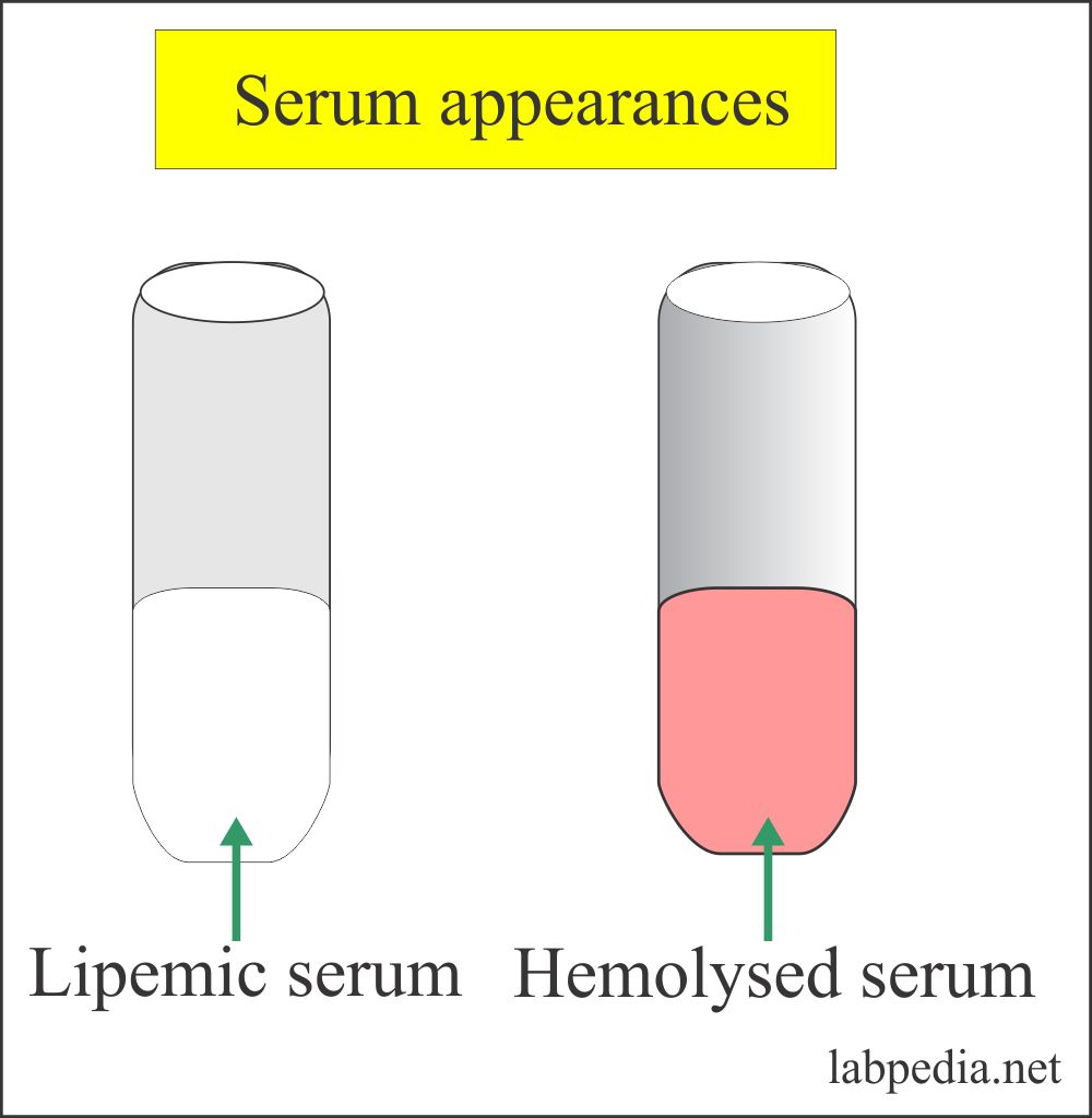 Common Lab Errors, and Effect of various Anticoagulants on Tests ...