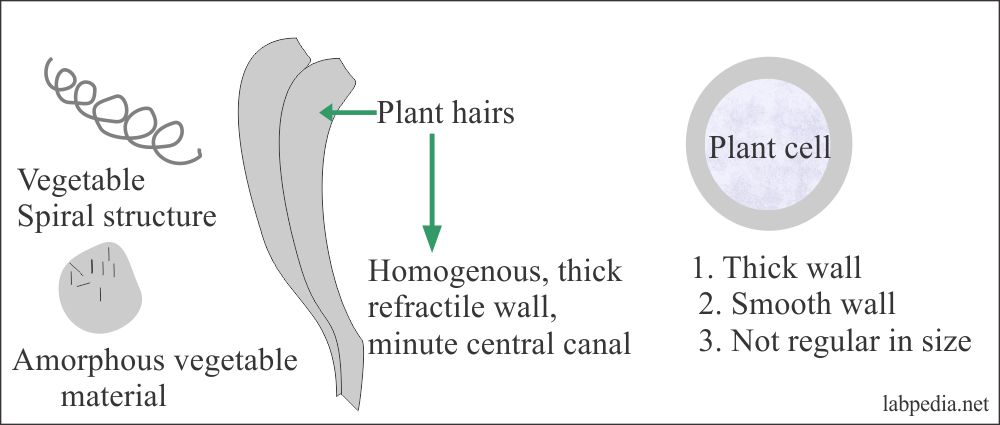 Stool Examination:- Part 1 – Stool Analysis , Complete Stool studies ...