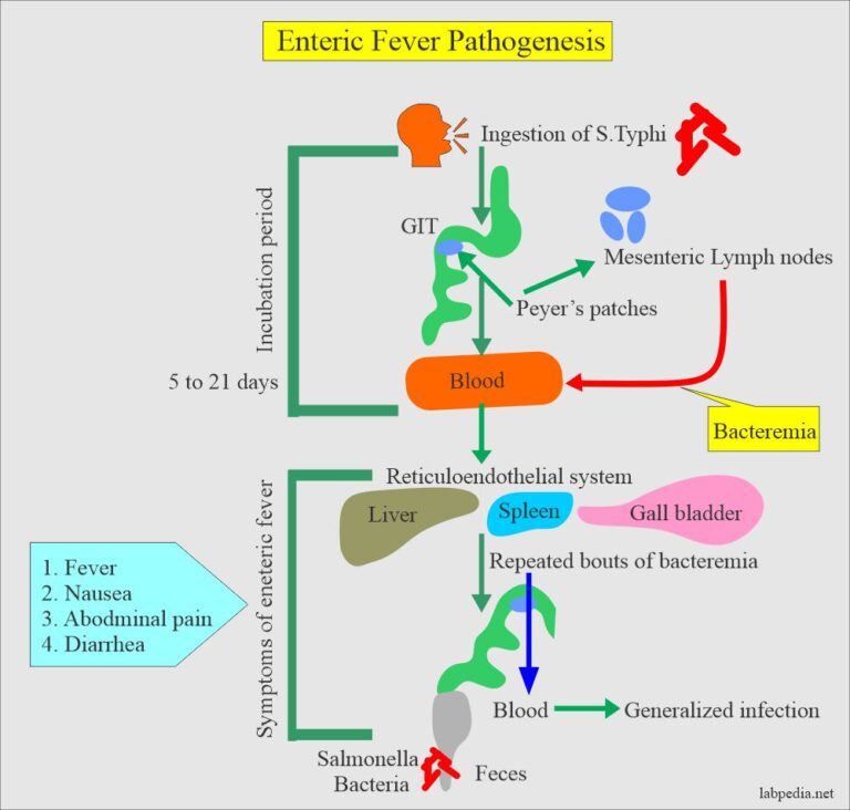 Enteric fever – Part 2 – Typhoid / Enteric fever Diagnosis, Widal test ...