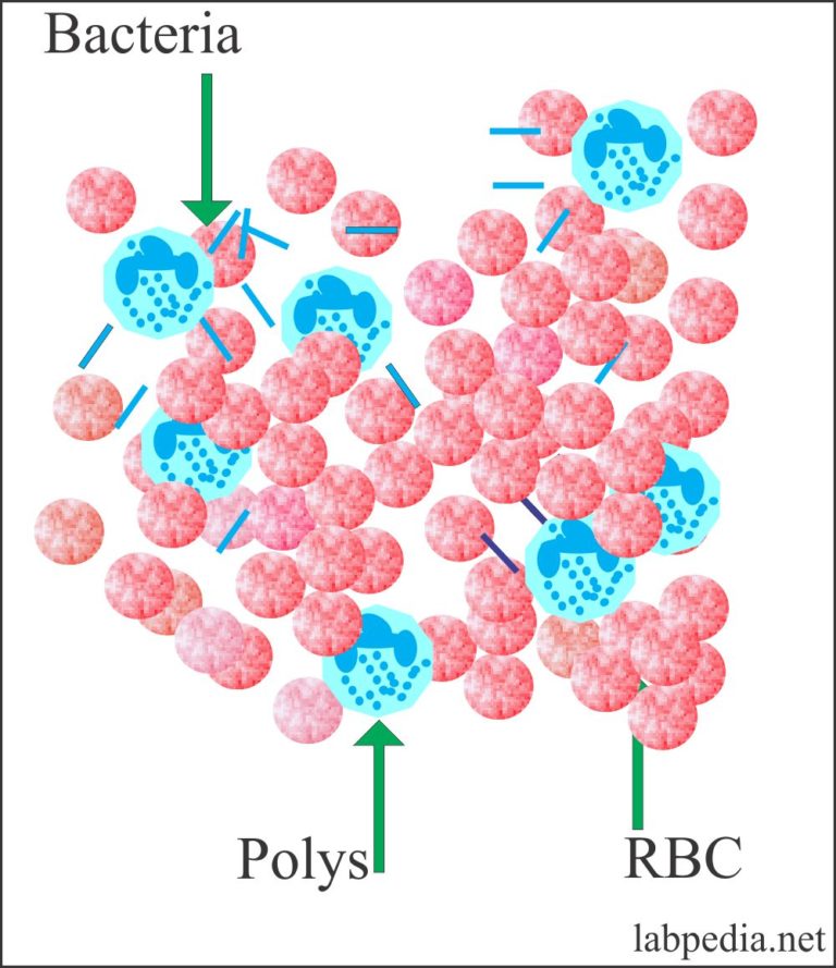 Microscopic Urinalysis With Mark