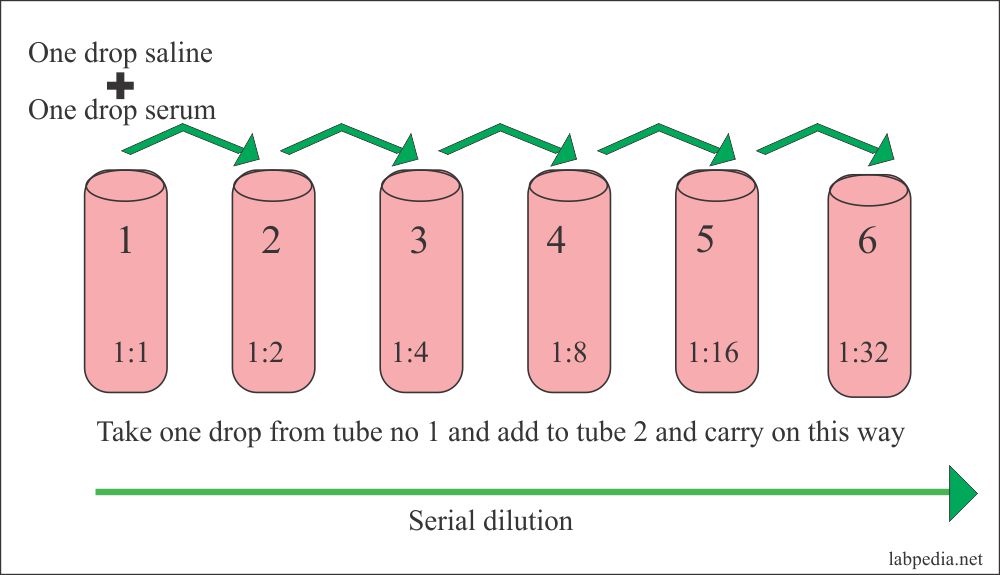 Enteric Fever Part 3 Typhoid Enteric Fever Diagnosis Widal Test enteric-fever-part-3-typhoid-enteric-fever-diagnosis-widal-test