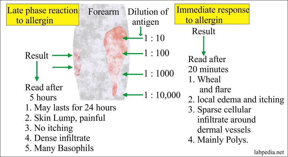 Chapter 11: Hypersensitivity Reactions, Type 1 Hypersensitivity ...