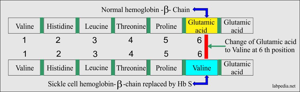 Anemia – Part 5 – Sickle Cell Anemia, and Sickle Cell Trait, Discussion ...